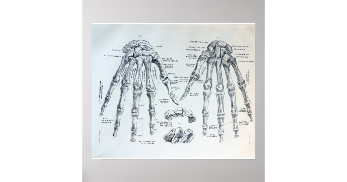Medische illustratie van de botten van de hand poster | Zazzle.nl
