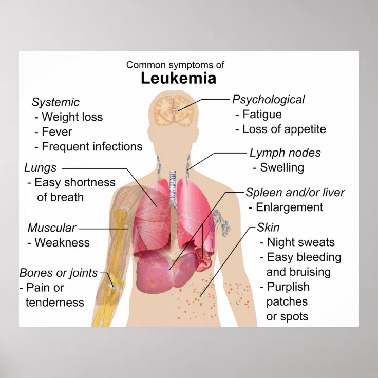 Vaak Voorkomende Symptomen Grafiek Van Leukemie Bl Poster Zazzle Nl
